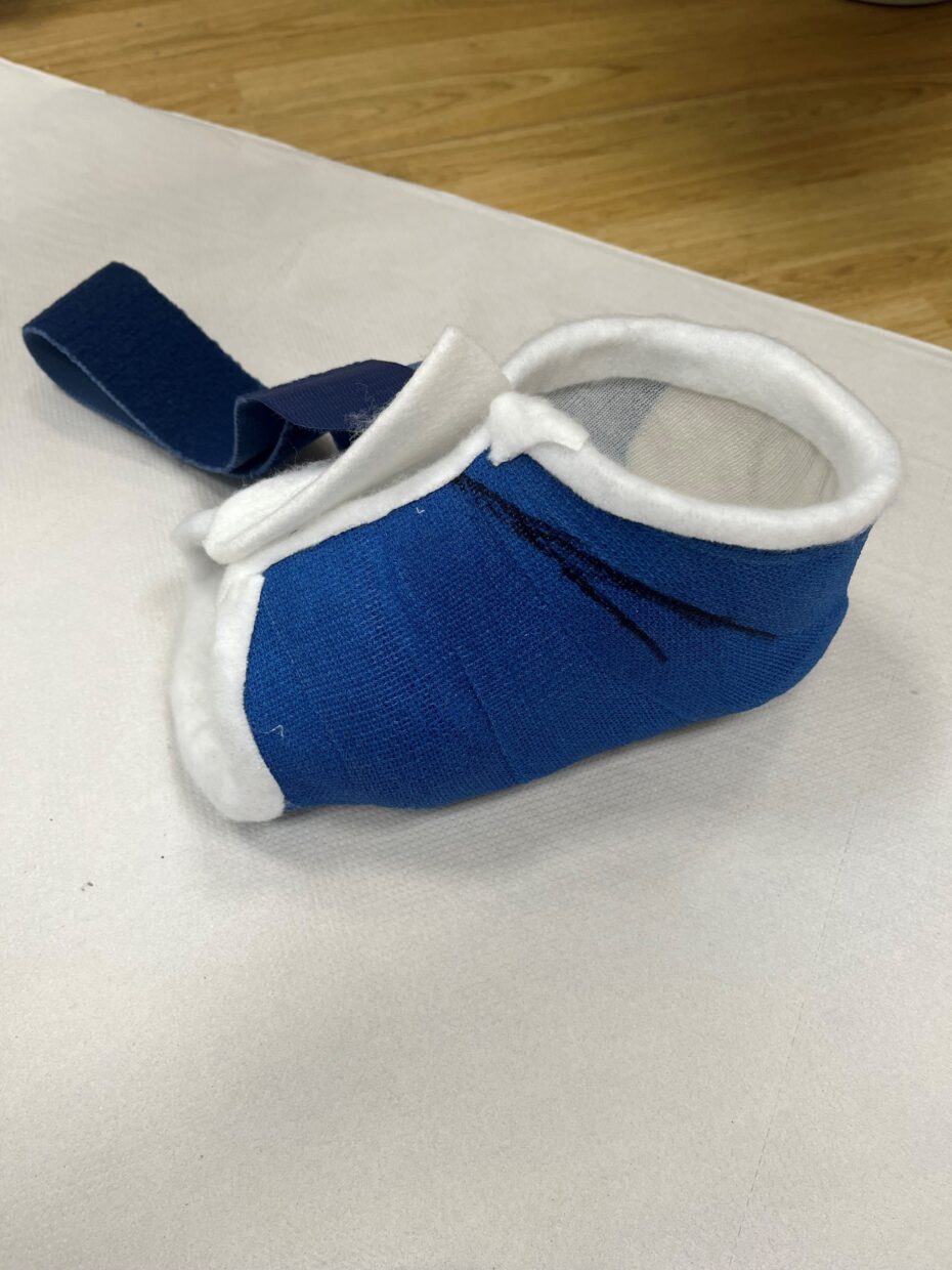 Looking after your cast - Bradford District Care NHS Foundation Trust