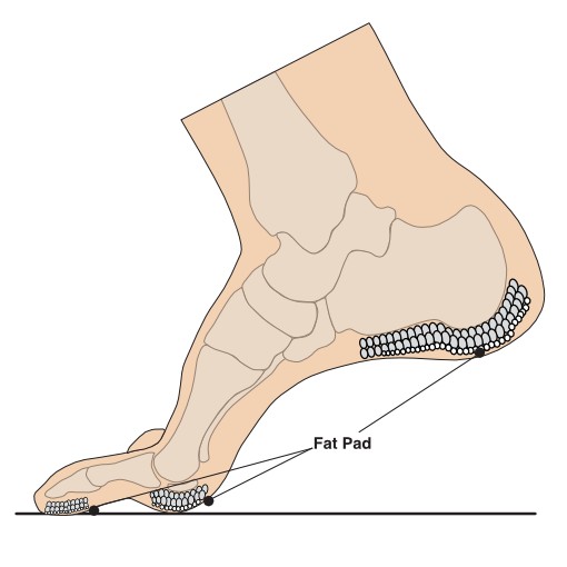 Pain in your toe or the ball of your foot - Metatarsalgia - Bradford ...